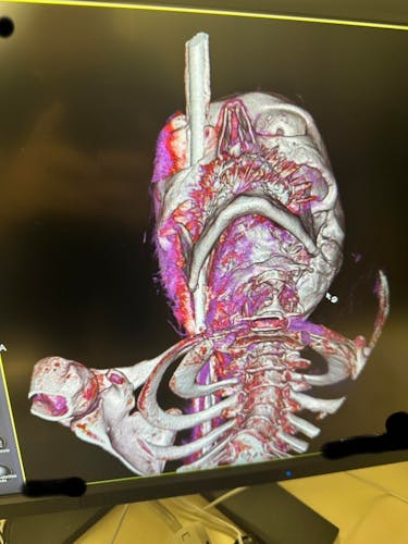 Nephrology Times | Docwire News