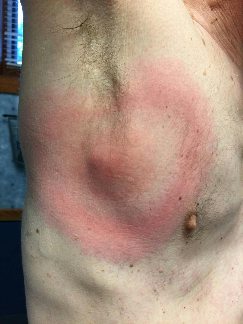 Physician's Weekly | www.PhysiciansWeekly.com