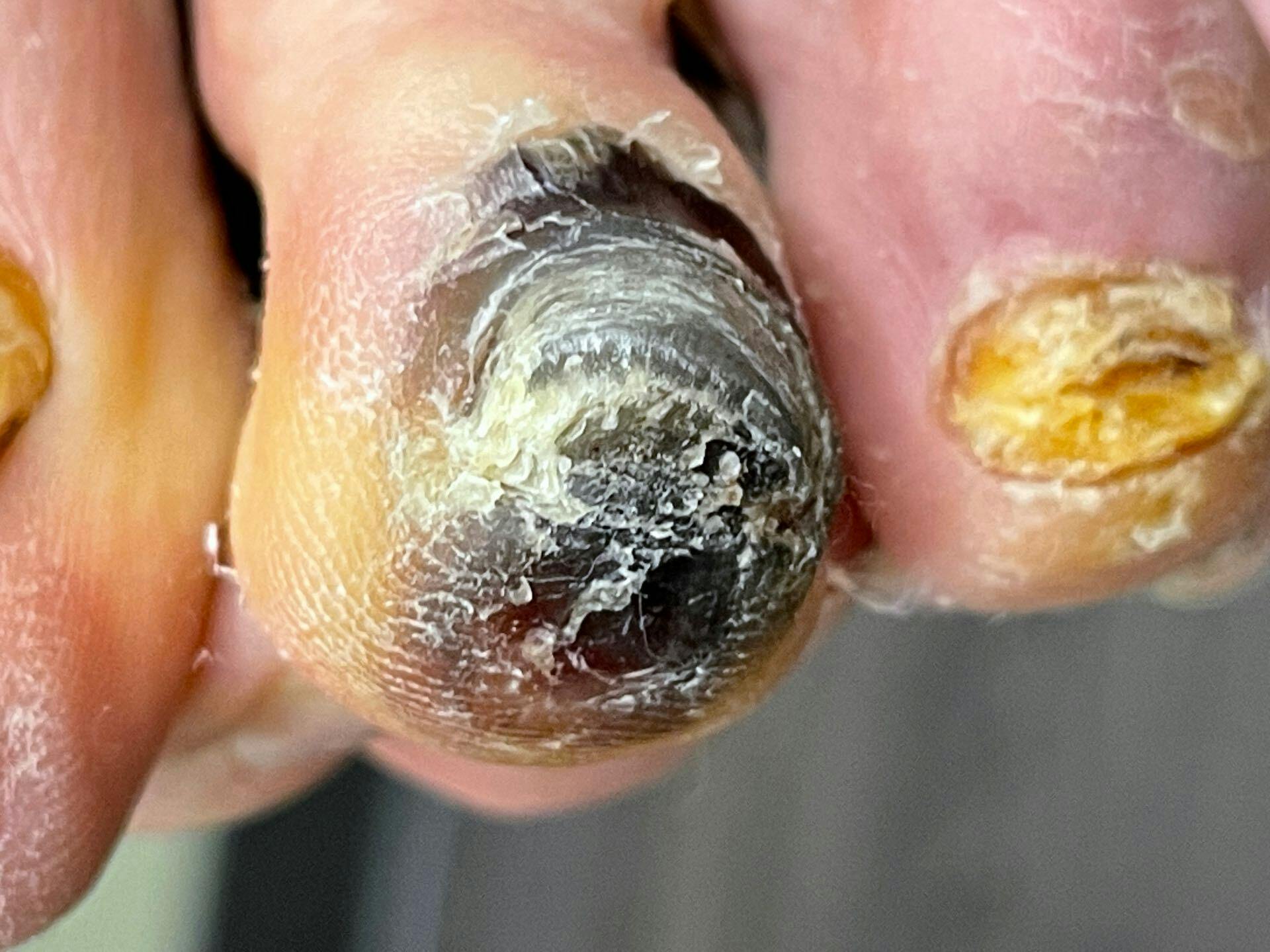 Physician's Weekly | www.PhysiciansWeekly.com